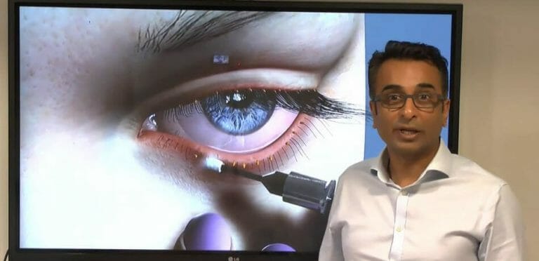 Infographic: Myopia control - OPTIMED